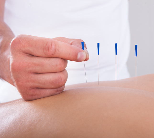 What is acupuncture? A health treatment guide | Simplyhealth